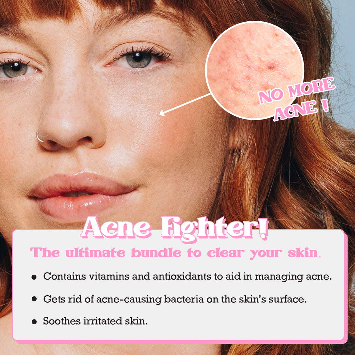 Acne Fighter (Bundle) - 30ml x 2 – CosBellus